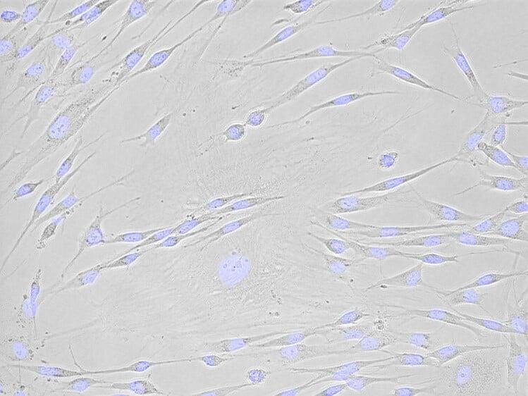 Primary Dermal Fibroblasts for Research | BioTether Sciences, Inc.